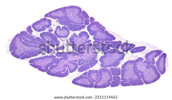Low Power Light Microscope Micrograph Human Stock Photo 2211119665 ...