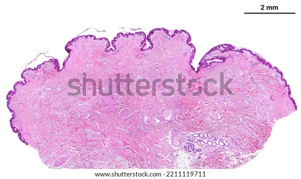 Low Power Light Microscope Micrograph Human Stock Photo 2211119711 ...
