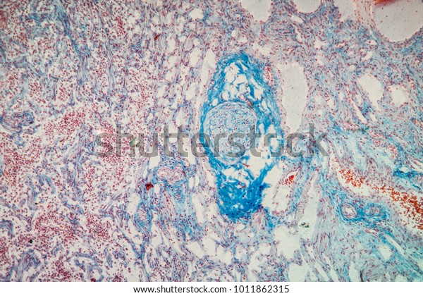 Lymph Node Tissue Under Microscope 100x Stock Photo 1011862315 ...