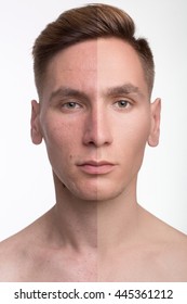 506 Man Before And After Cosmetic Procedures Images, Stock Photos ...
