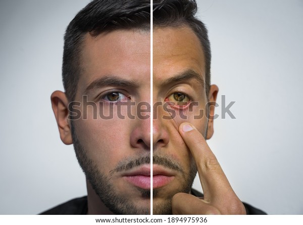 Man Face Divided Into Two Parts Stock Photo 1894975936 | Shutterstock