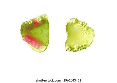 Mandibular Partial Denture Resin Frame Wax Stock Photo 1961543461 ...