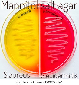 84 imágenes de Mannitol salt agar - Imágenes, fotos y vectores de stock ...