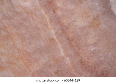 Multiple Illdefine Erythematous Rash Back Man Stock Photo 1864564525 ...