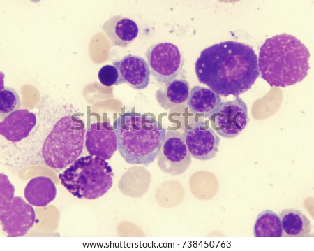 Mast Cell Basophil Comparison Stock Photo (Edit Now) 738450763 ...