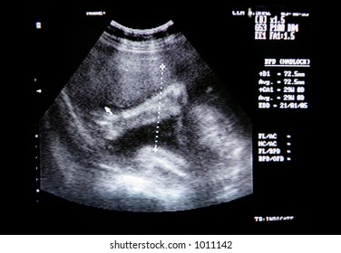 4,320 Baby x ray Images, Stock Photos & Vectors | Shutterstock