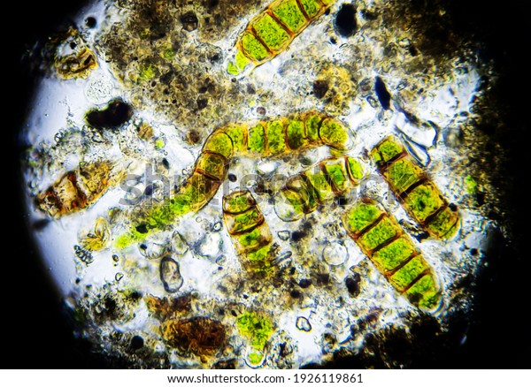 Microalgae Under Microscope Sample Taken Moss Foto stock 1926119861 ...
