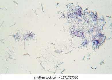 6,010 Microbes Under Microscope Images, Stock Photos & Vectors ...