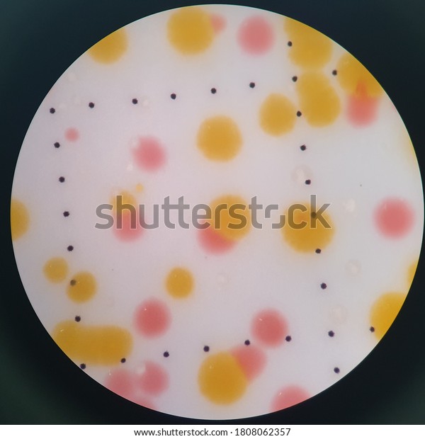 Microbial Observation Under Laboratory Microscope Stock Photo ...