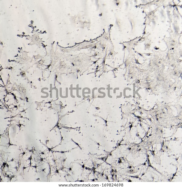 Micrograph Nerve Cell Nervous Physiology Science Stock Photo 169824698 ...