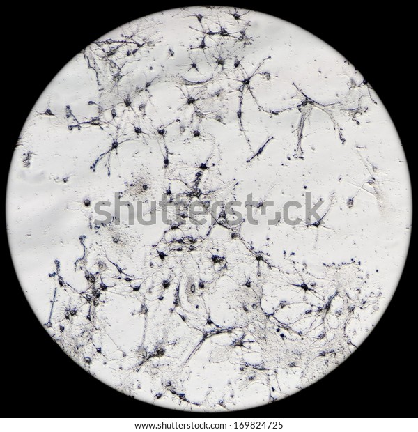 Micrograph Nerve Cell Nervous Physiology Science Stock Photo 169824725 ...