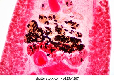 9,257 Worm body Images, Stock Photos & Vectors | Shutterstock