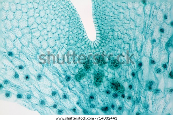 Microscope Fixed Slide View Fern Prothallium Stock Photo (Edit Now ...