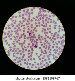 Nucleated Red Blood Cells Fish Fish Stock Photo (Edit Now) 766422241