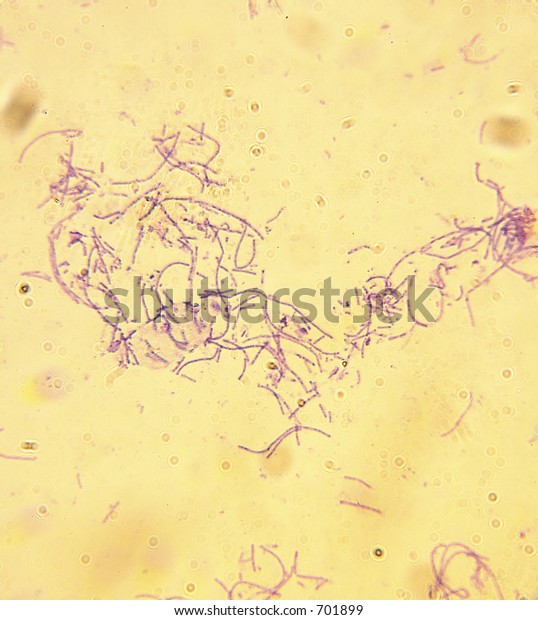 Microscope Photo Anthrax Bacillus Anthracis Focusleft Stock Photo (Edit ...