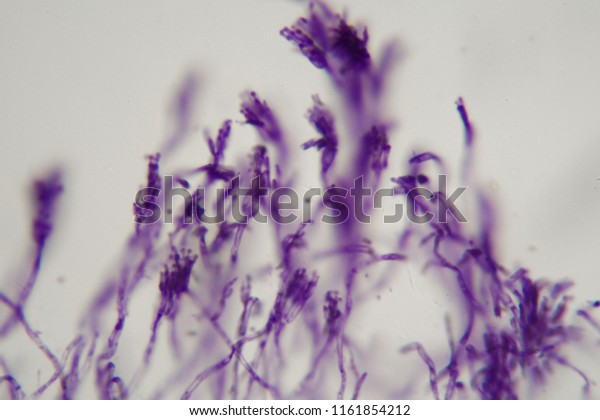 Microscope Photo Bundle Blue Stained Penicillium Stock Photo 1161854212 ...
