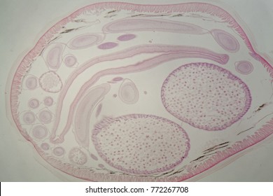 Microscope Photo Cross Section Through Parasitic Stock Photo 772267708 ...