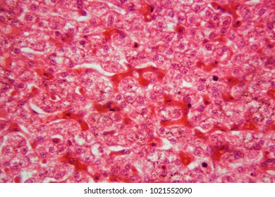 Microscope Photo Section Through Pig Liver Stock Photo 1021552090 ...