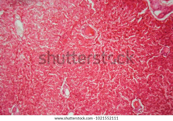 Microscope Photo Section Through Pig Liver Stock Photo 1021552111 ...