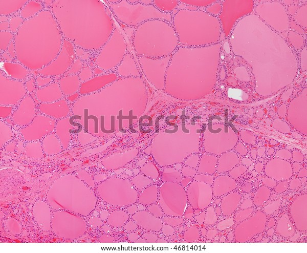 Microscope Picture Human Thyroid Gland Stock Photo (Edit Now) 46814014
