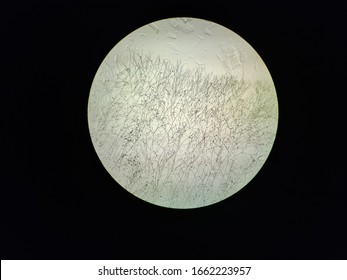 Microscope View Dermatophyte Isolated Human Skin Stock Photo 1662223957 ...