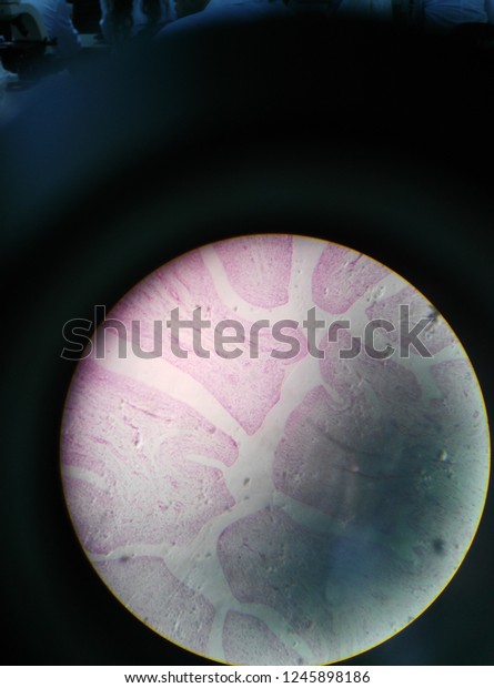 Microscope View Gallbladder Muscle Bladder Kidney Stock Photo ...