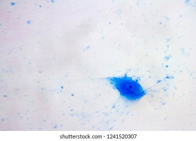 Microscope View Giant Multipolar Neuron Foto stock 1241520307 ...