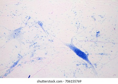 Microscope View Giant Multipolar Neuron Stock Photo (Edit Now) 706155769