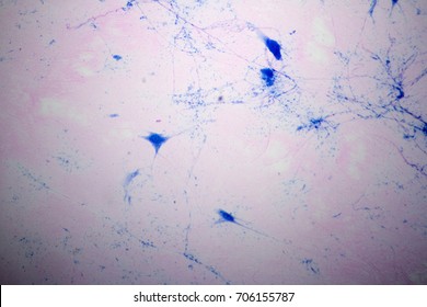 Microscope View Giant Multipolar Neuron Stock Photo (Edit Now) 706155787