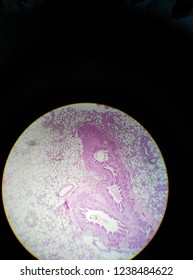 Larynx Microscope View Stock Photo (Edit Now) 1240008247