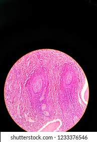 353 Spleen microscope Images, Stock Photos & Vectors | Shutterstock