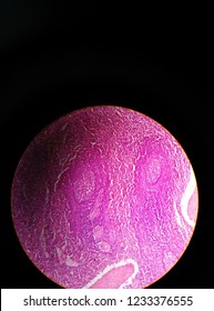 353 Spleen microscope Images, Stock Photos & Vectors | Shutterstock