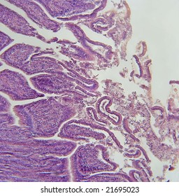 Microscopic Cross Section Ileum Portion Wall Foto de stock 21695023 ...