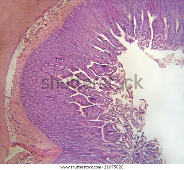 Microscopic Cross Section Ileum Portion Wall Stock Photo (Edit Now ...