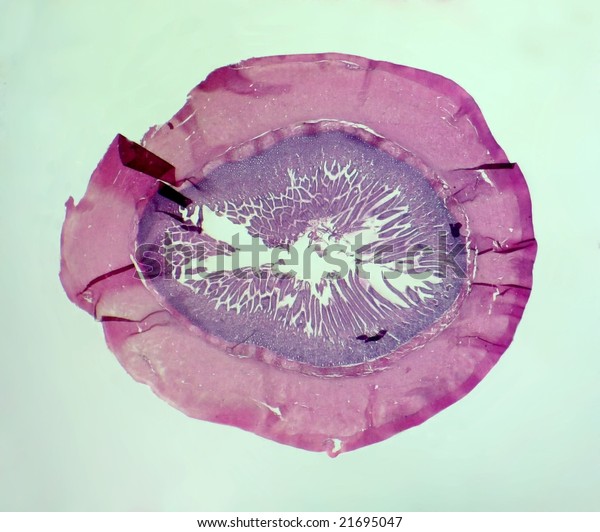 Microscopic Cross Section Jejunum Portion Wall Foto stock 21695047 ...