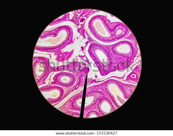 Microscopic Cross Section Testes Testis Ts Stock Photo 155530427 ...