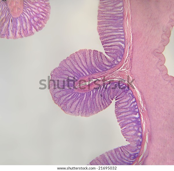 Microscopic cross section of the wall of the large intestine