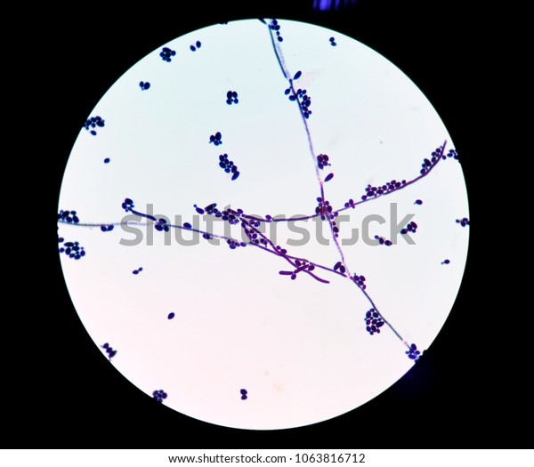 Microscopic Examination Candida Albicans Found Budding Stock Photo ... Microscopic Examination Candida Albicans Found Budding Stock Photo ...