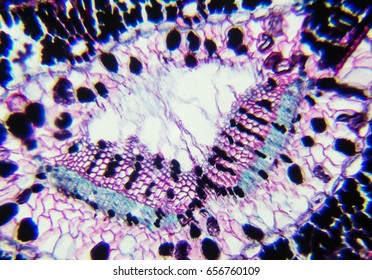 Microscopic Image Pine Leaf Whole Mount Stock Photo 656760109 ...