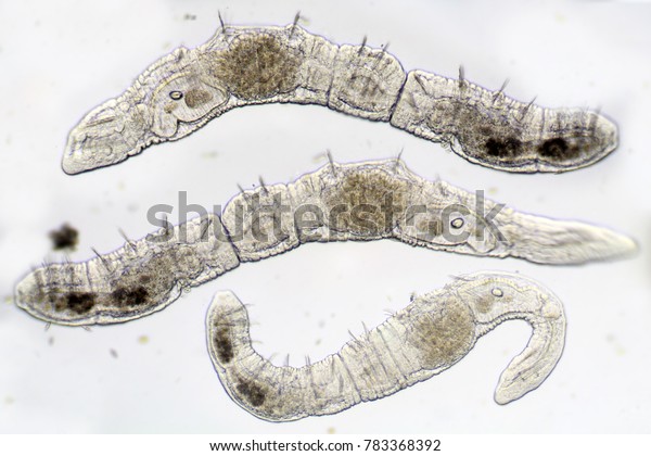 Microscopic Polychaete Bristle Worms Under Microscope Stock Photo ...