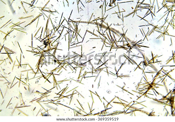 Microscopic Single Cell Animals Found Fresh Stock Photo 369359519 ...