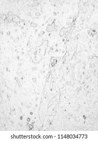 Microscopic View Curd Seen Microscope Lactobacillus Stock Photo ...