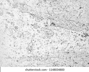 Microscopic View Curd Seen Microscope Lactobacillus写真素材1148034800 ...