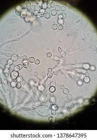 Scopulariopsis Images, Stock Photos & Vectors | Shutterstock