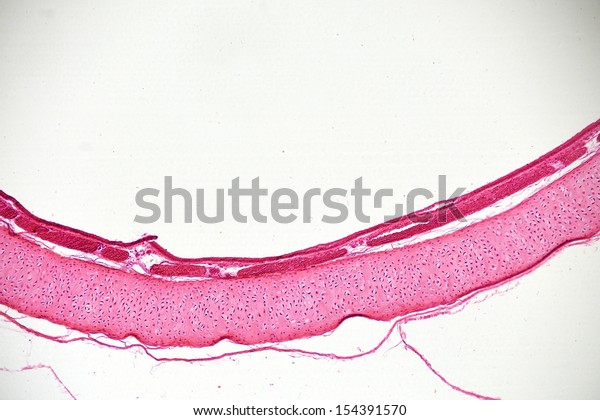 Microscopic View Trachea Stock Photo (Edit Now) 154391570