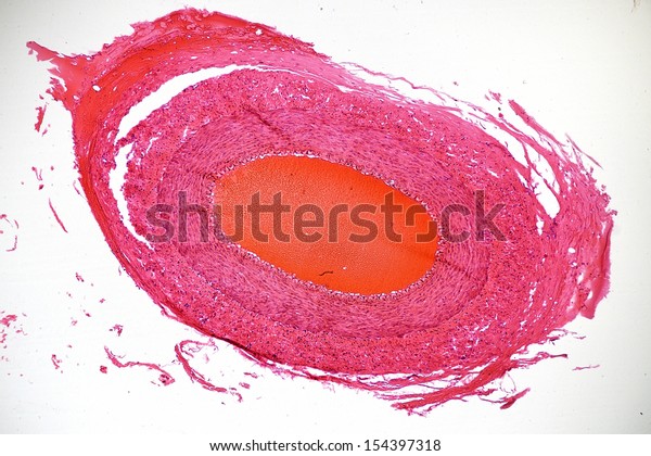 Microscopic View Vein Stock Photo 154397318 | Shutterstock