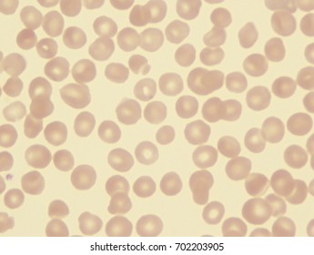 Microspherocyte Stock Photo 702203905 | Shutterstock