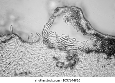 Mold Spores Images, Stock Photos & Vectors | Shutterstock