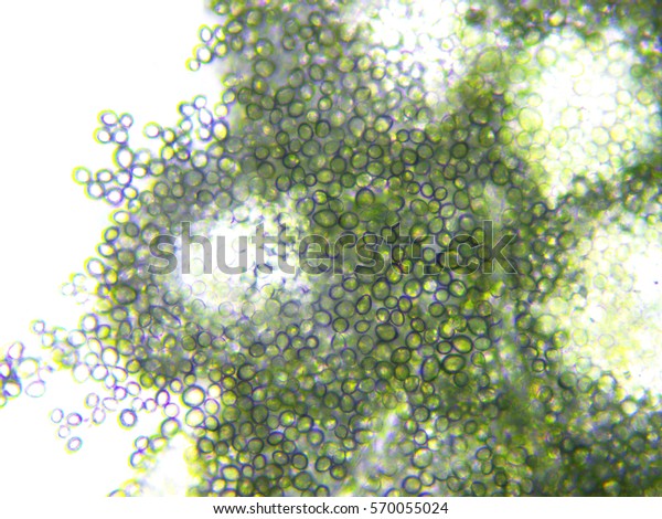 Mold Microscopic View Stock Photo (Edit Now) 570055024