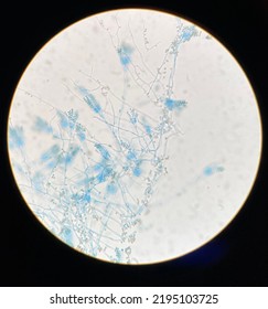 Mold Structure Under Microscope Preparation By Stock Photo 2195103725 ...
